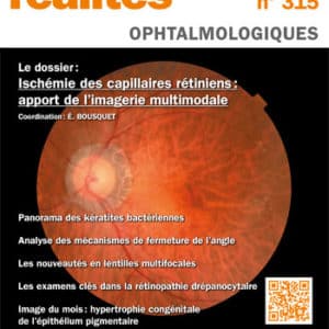 Dossier : Neuropathies optiques non glaucomateuses de l’adulte Archives ...